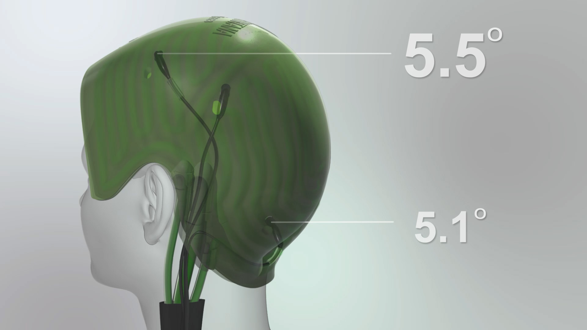 learn about Dignitana dignicap cooling circuits animationIsland Monkey